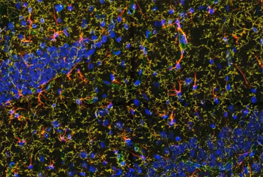 New method exposes structures inside ‘rainbow’ of brain cells | The ...