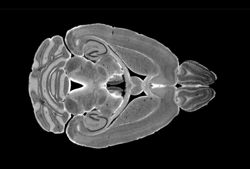 New mouse brain atlas traces connections in fine detail | The ...