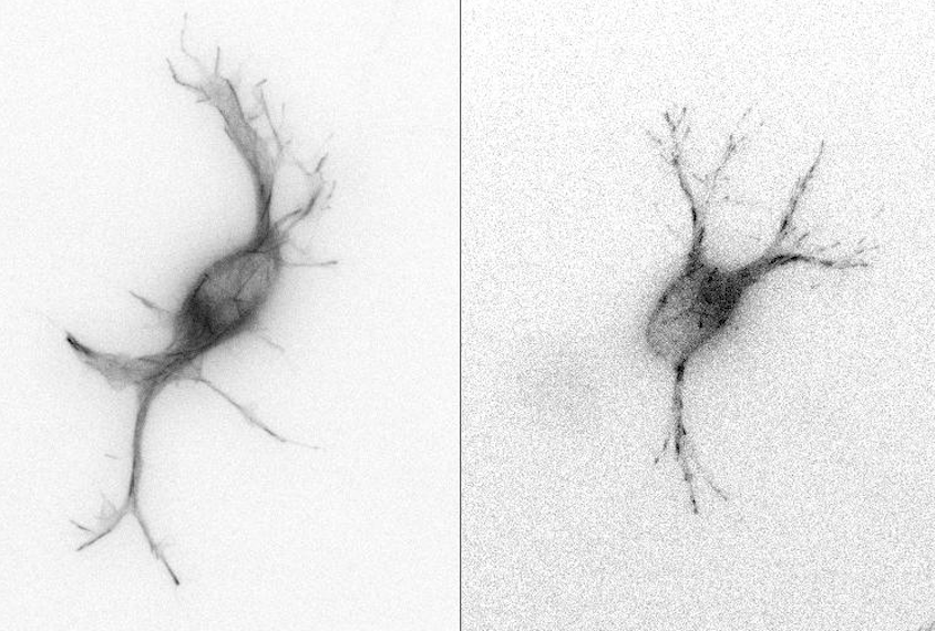 Gene In Autism Hotspot Regulates Neuronal Migration The Transmitter Neuroscience News And