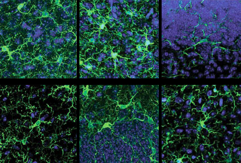 Mapping tool reveals microglia’s shape-shifting secrets | The ...