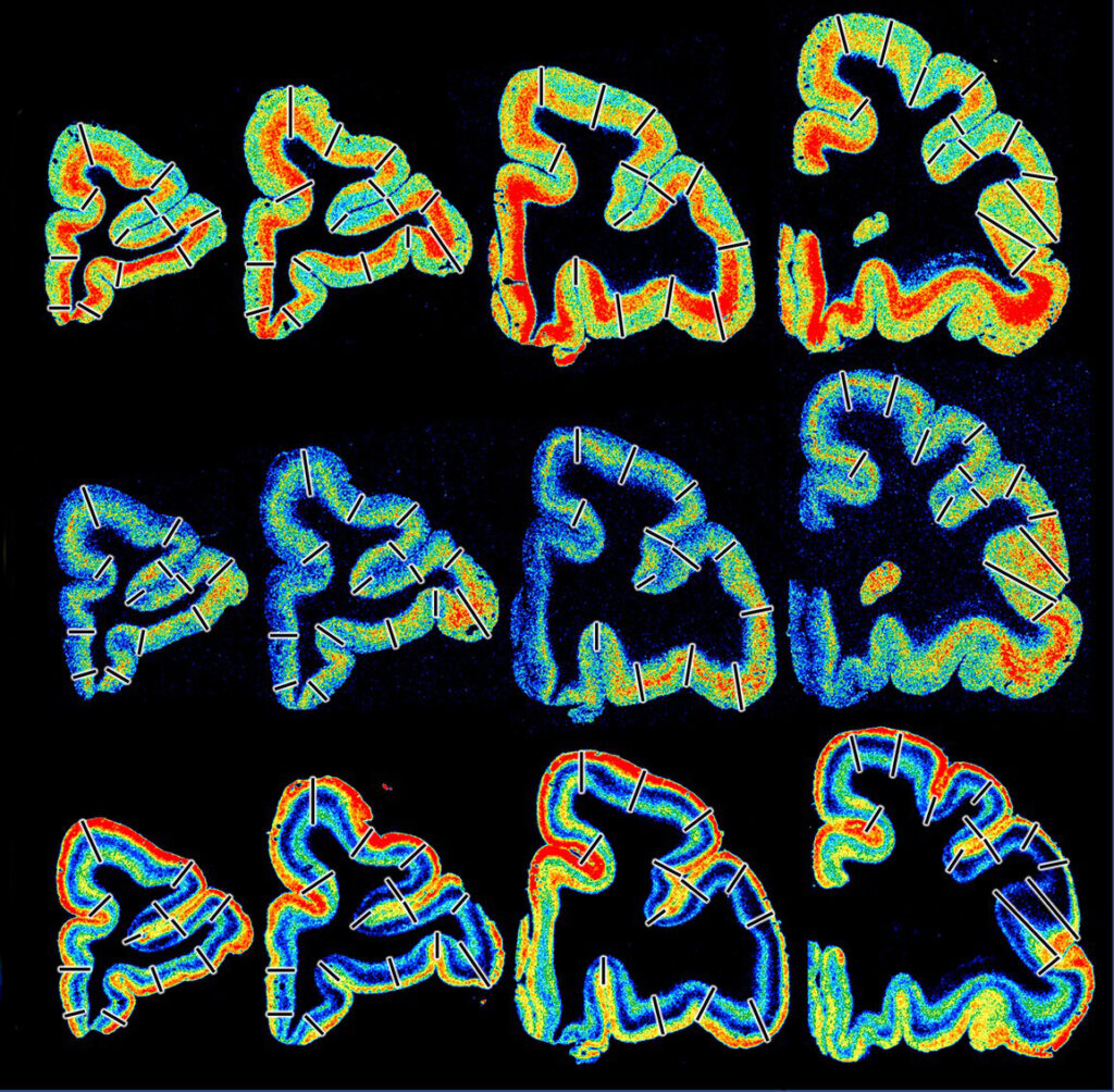 Monkey brain mapping; statistics guidance; CUL3 gene | The Transmitter ...