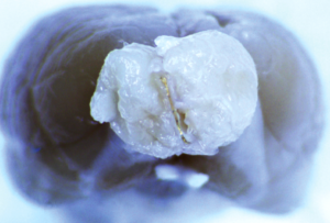 Brain-surgery-free probes can record single-neuron activity | The ...