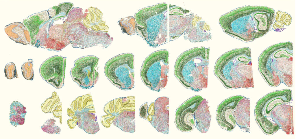 SHANK3 and olfaction; spatial atlas of mouse brain; persistence of ...