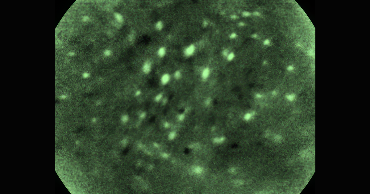 Designing an open-source microscope | The Transmitter: Neuroscience ...