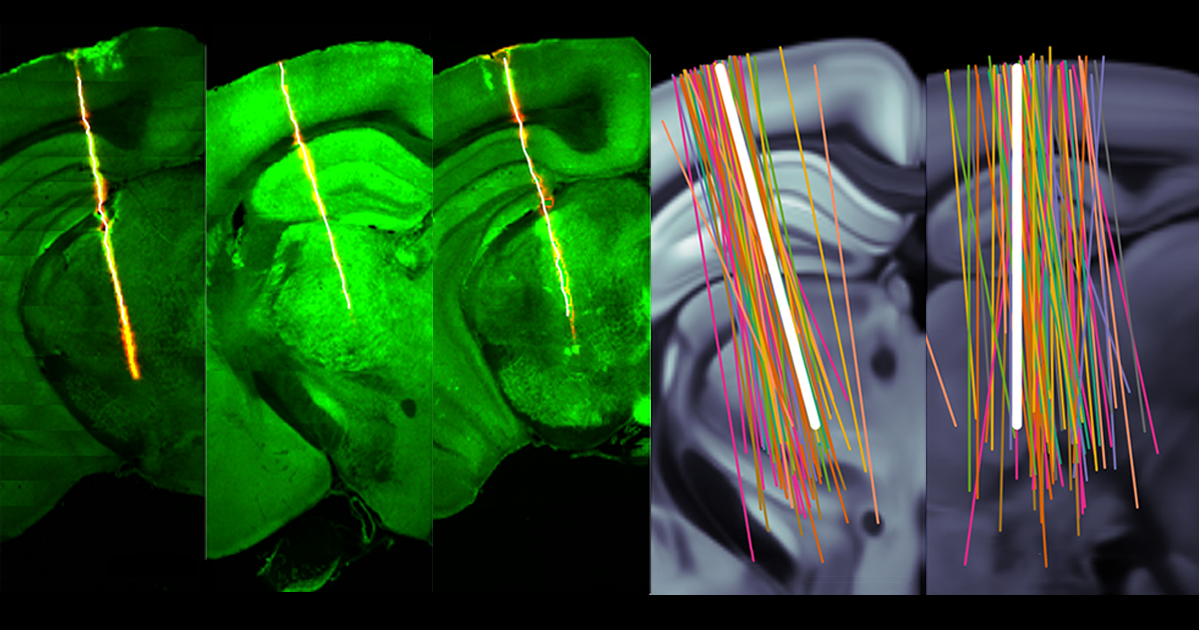 10 standards for brain electrode-array recordings enhance ...