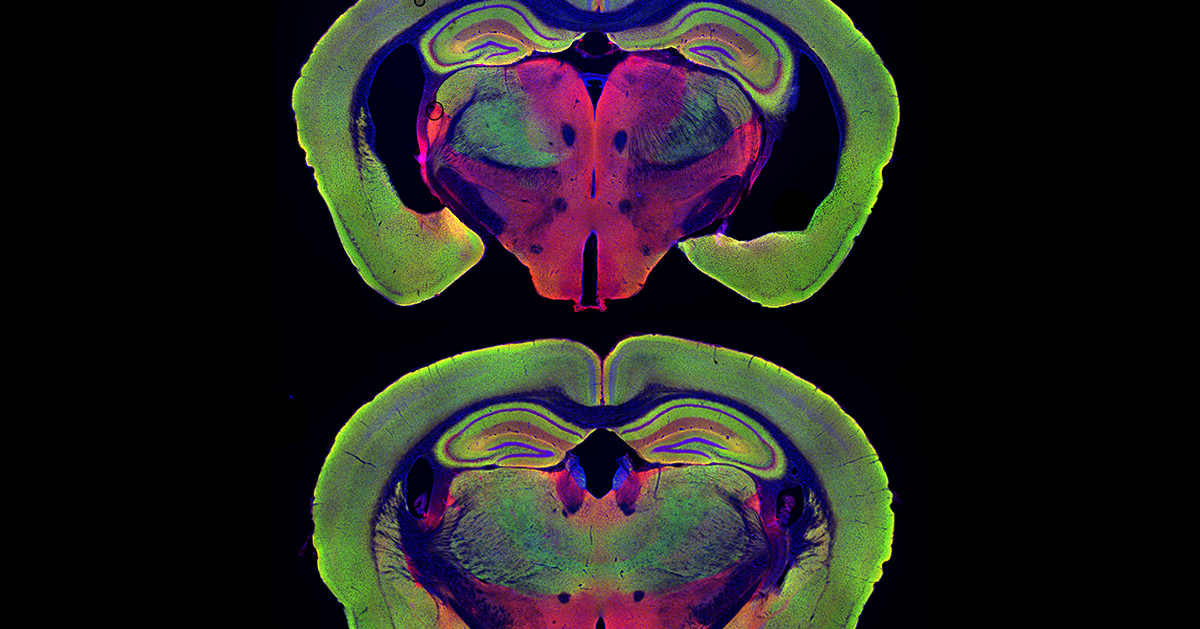 Putting a bright idea to the test | The Transmitter: Neuroscience News ...