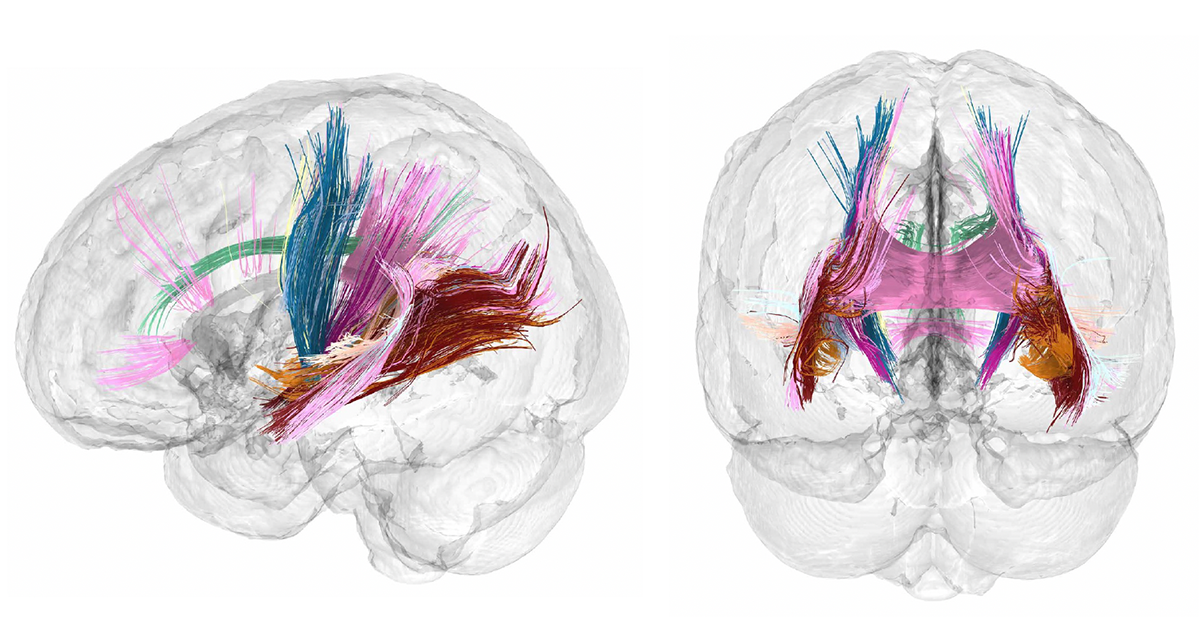 Repeat scans reveal brain changes that precede childbirth | The ...