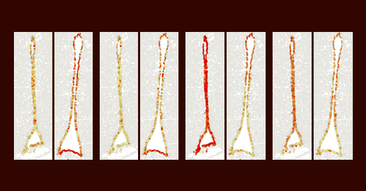 Age-related brain changes in mice strike hypothalamus ‘hot spot’ | The ...