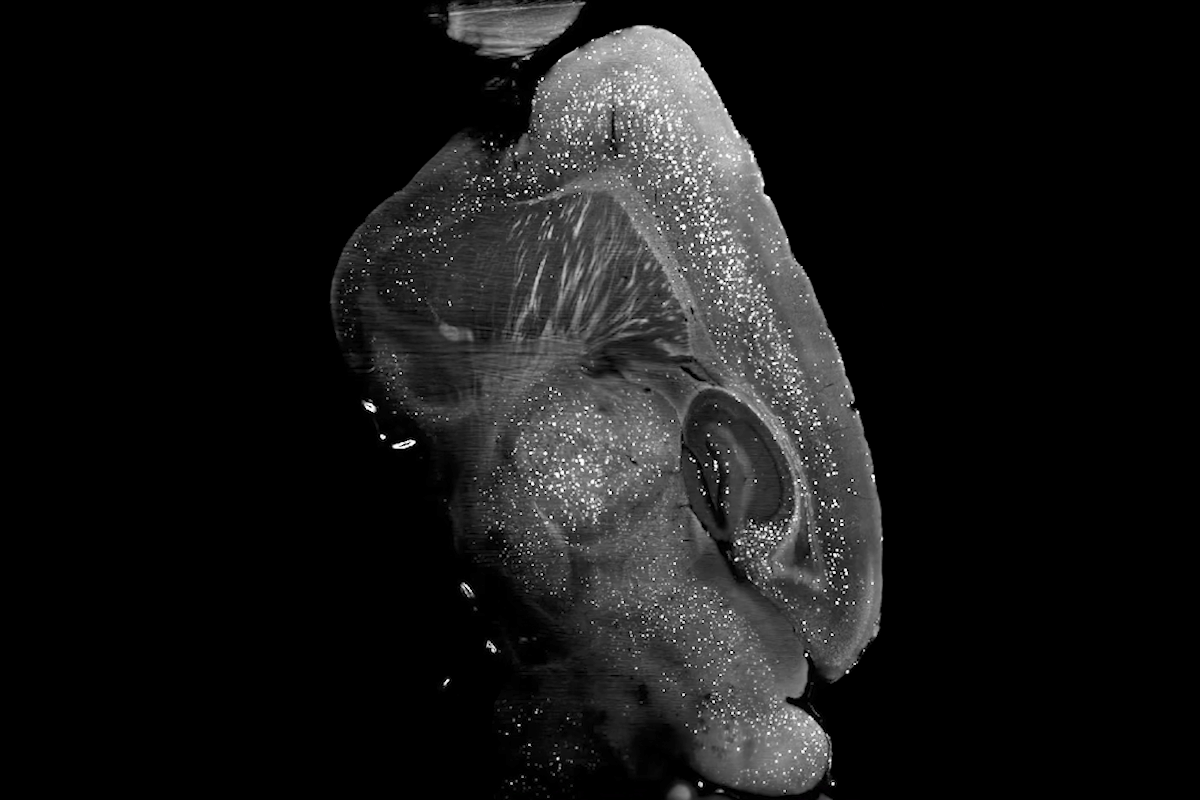Plaque levels in Alzheimer’s mouse model depend on pedigree | The ...