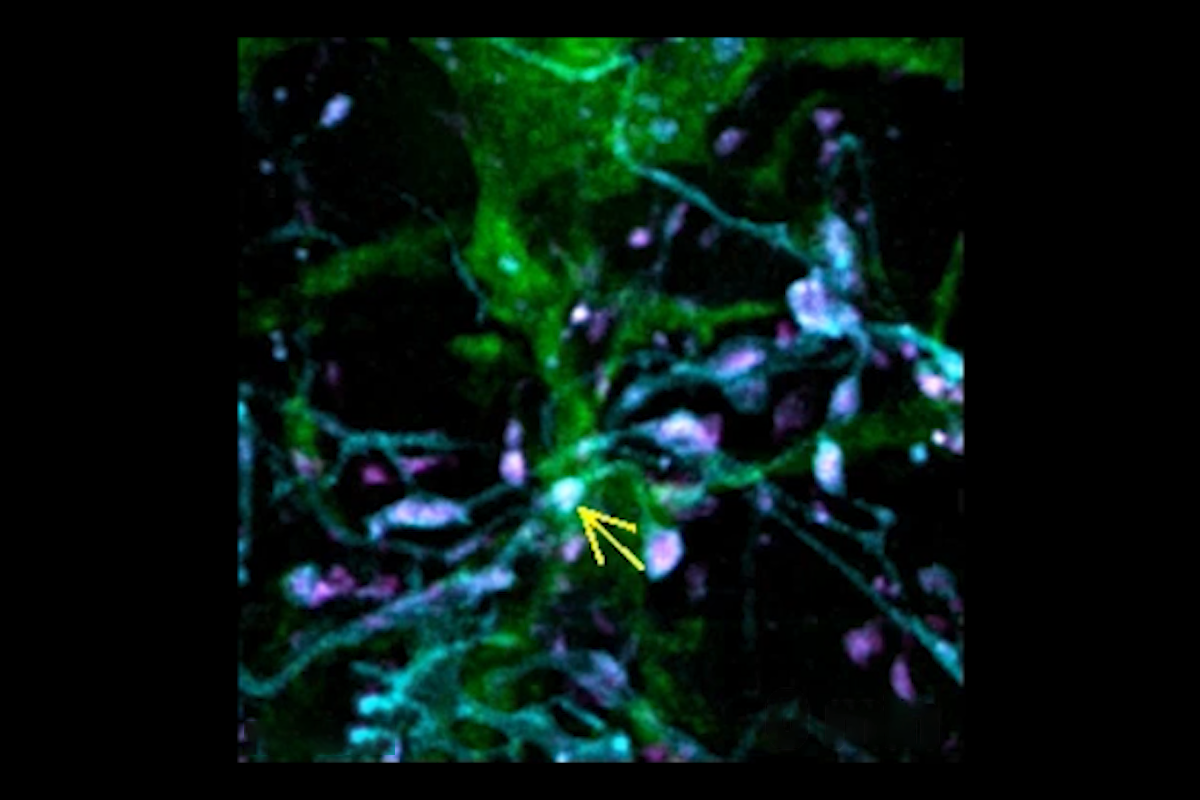 Video catches microglia in the act of synaptic pruning | The ...