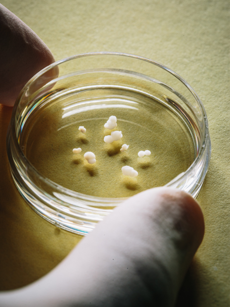 Organoids and assembloids offer a new window into human brain | The Transmitter: Neuroscience ...