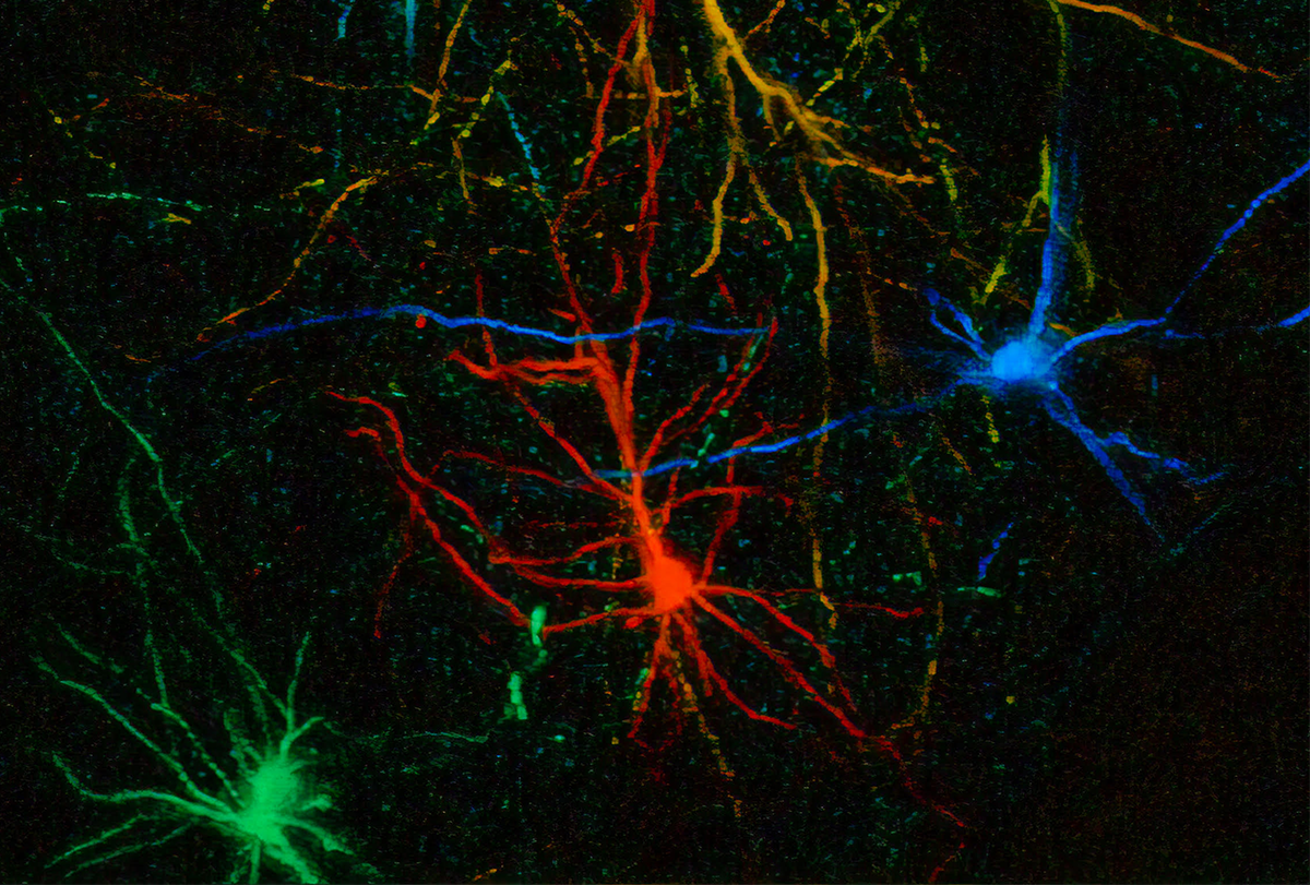 In vivo veritas: Xenotransplantation can help us study the development ...