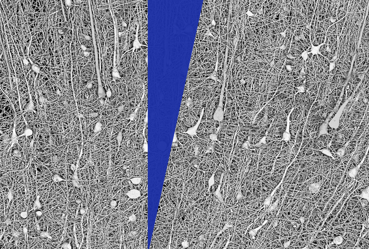 Multisite connectome teams lose federal funding as result of Harvard ...