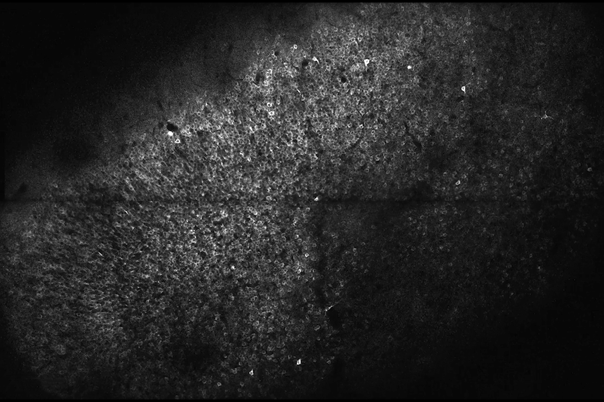 Expanded view of hippocampal function comes into focus | The ...