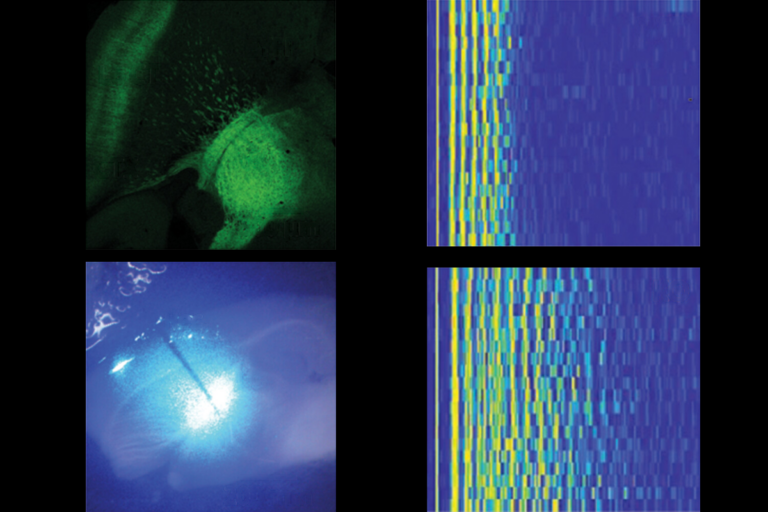 Sensory gatekeeper drives seizures, autism-like behaviors in mouse ...