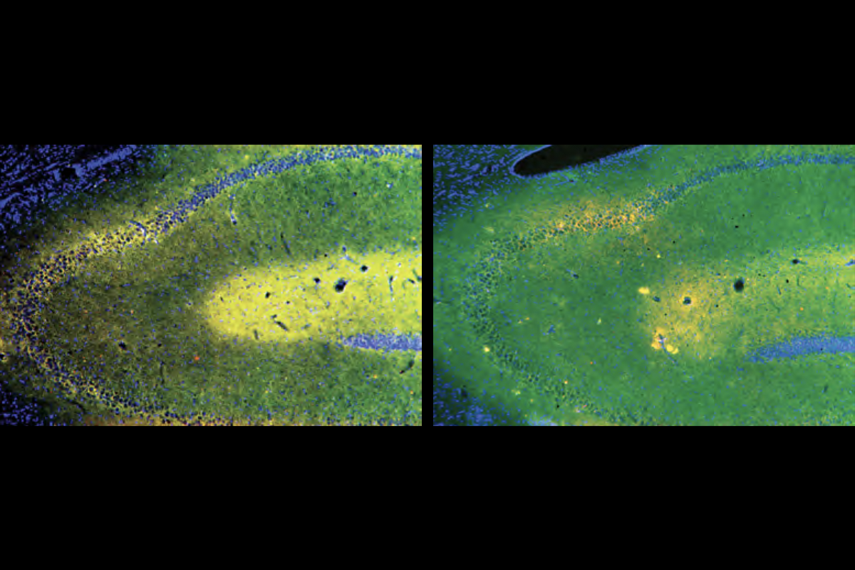 Impaired sensory learning in a mouse model of fragile X syndrome; and ...
