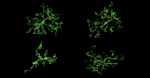 Functional connectivity links with autism, not ADHD; and more | The ...