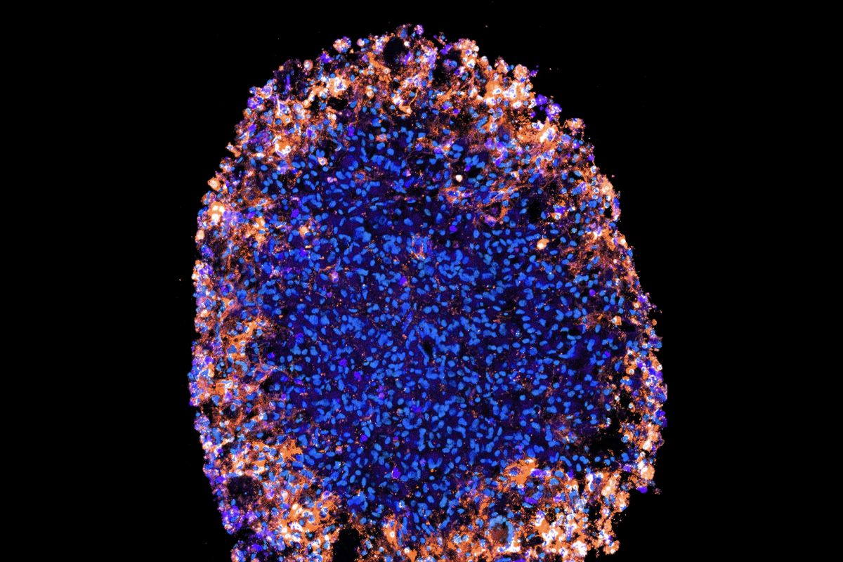 What is the future of organoid and assembloid regulation? | The ...