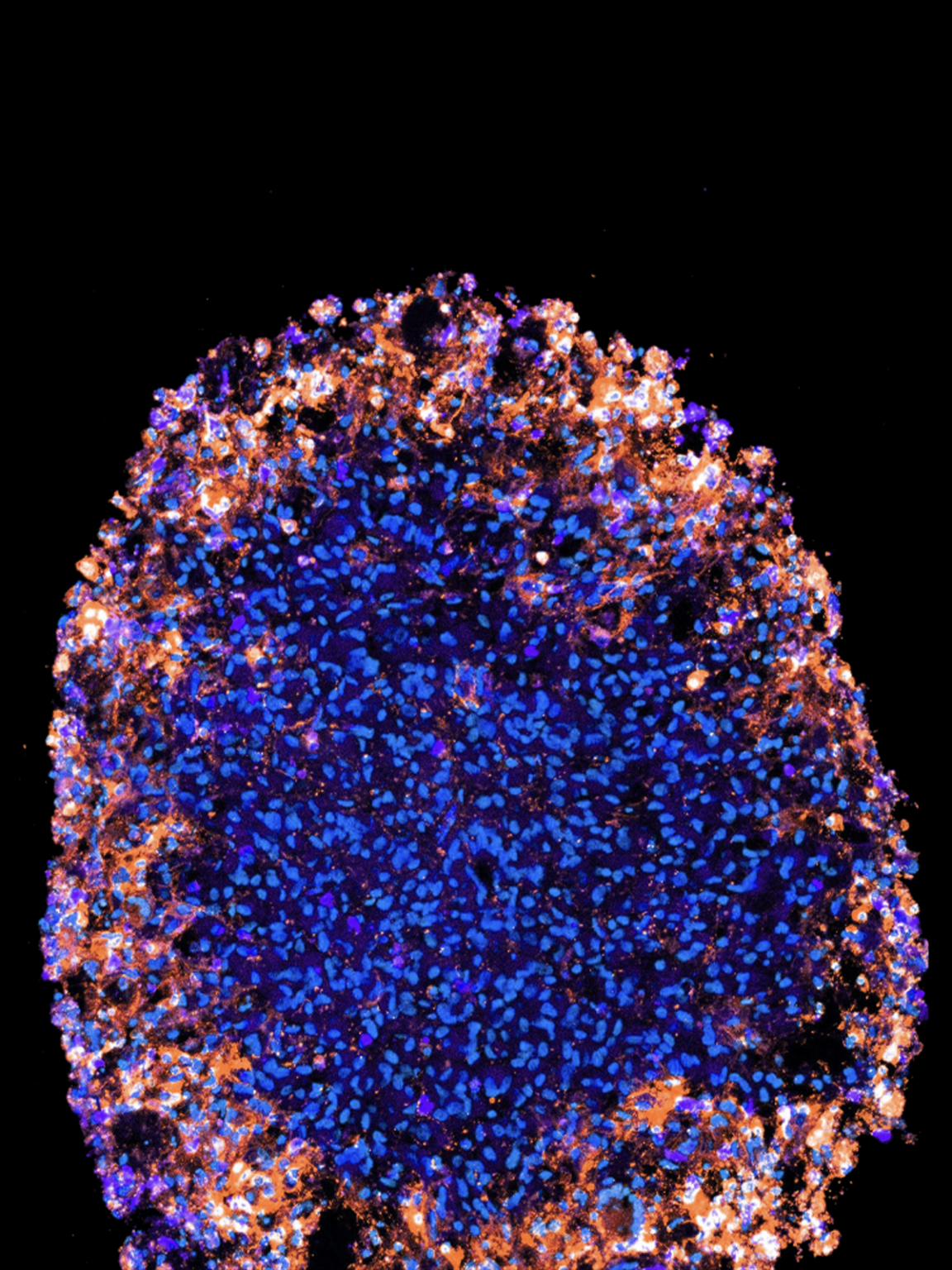 What is the future of organoid and assembloid regulation? | The ...