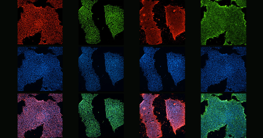 Bringing African ancestry into cellular neuroscience | The Transmitter ...