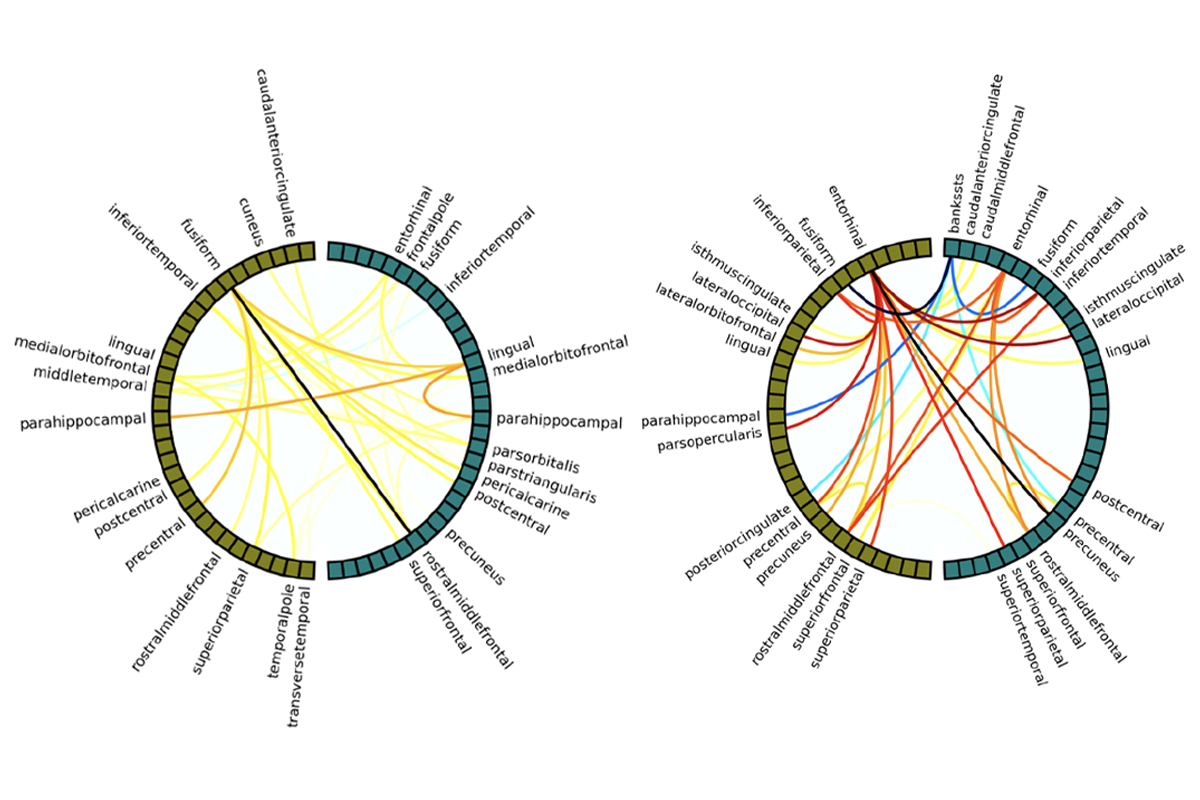 Monkeys with autism mutation show condition’s key traits | The ...