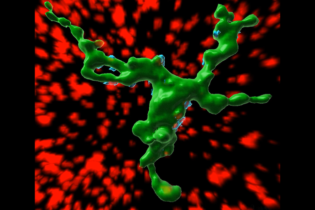 Microglia in hypothalamus help kick-start puberty | The Transmitter ...