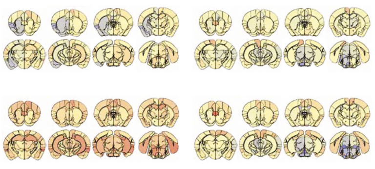 Outside influences on CHD8 variant phenotypes, and more | The ...