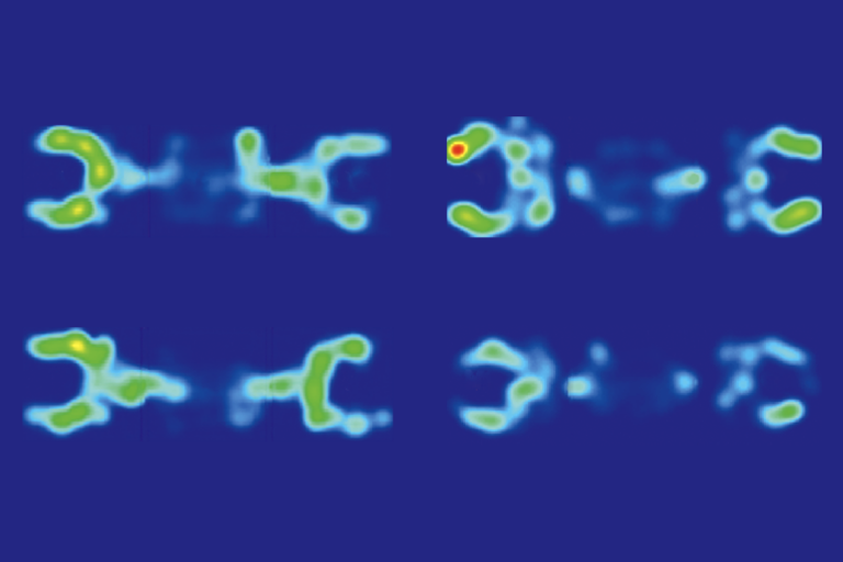 Noncoding RNA sways core autism traits in mice | The Transmitter ...