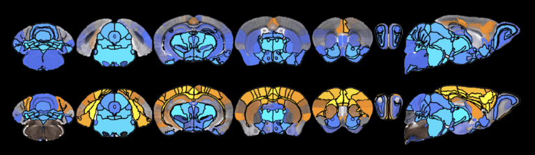 » A new subtyping model for autism phenotypes late in development, and more