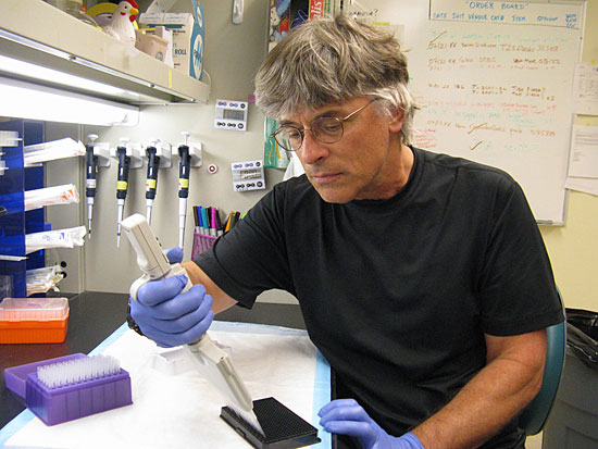 New blood test measures levels of fragile X protein | The Transmitter ...